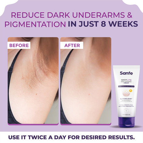 Cream for dark neck and underarms store
