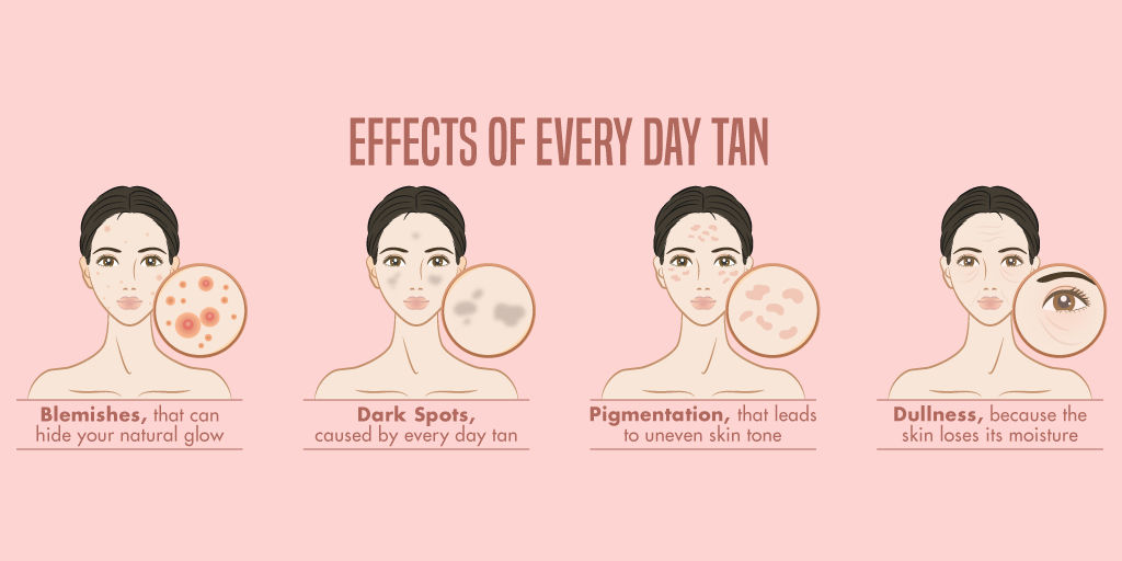 Nature's Essence Daily De-Tan Lacto Tan Clear (50 g)