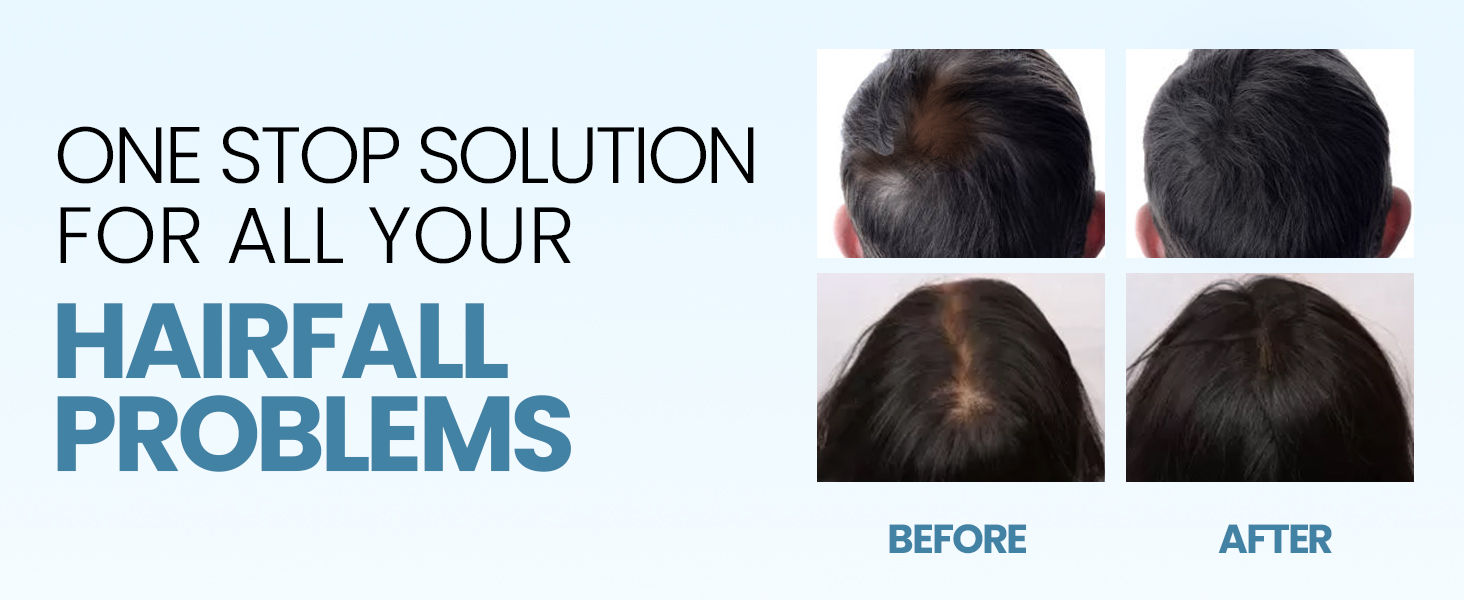 Buy Nature Sure Jonk Oil - Pure Leech Oil Online | Purplle