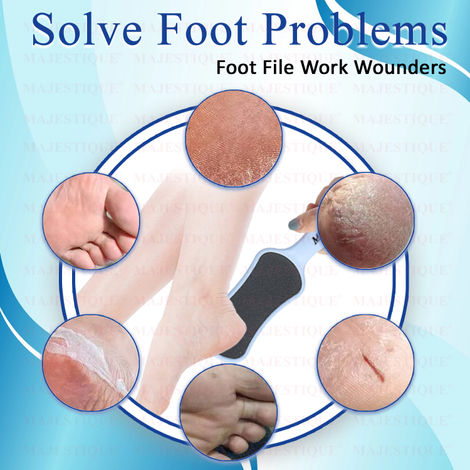 Majestique Foot Scrubber for Dead Skin, Pedicure Foot Rasp Removes ...