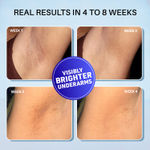 Buy DERMDOC by Purplle 5% Glycolic Acid Under Arm Treatment | Purplle